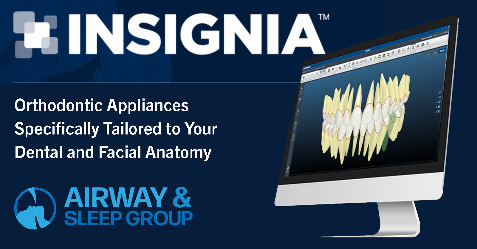 Insignia Digital Bracket System Airway And Sleep Group
